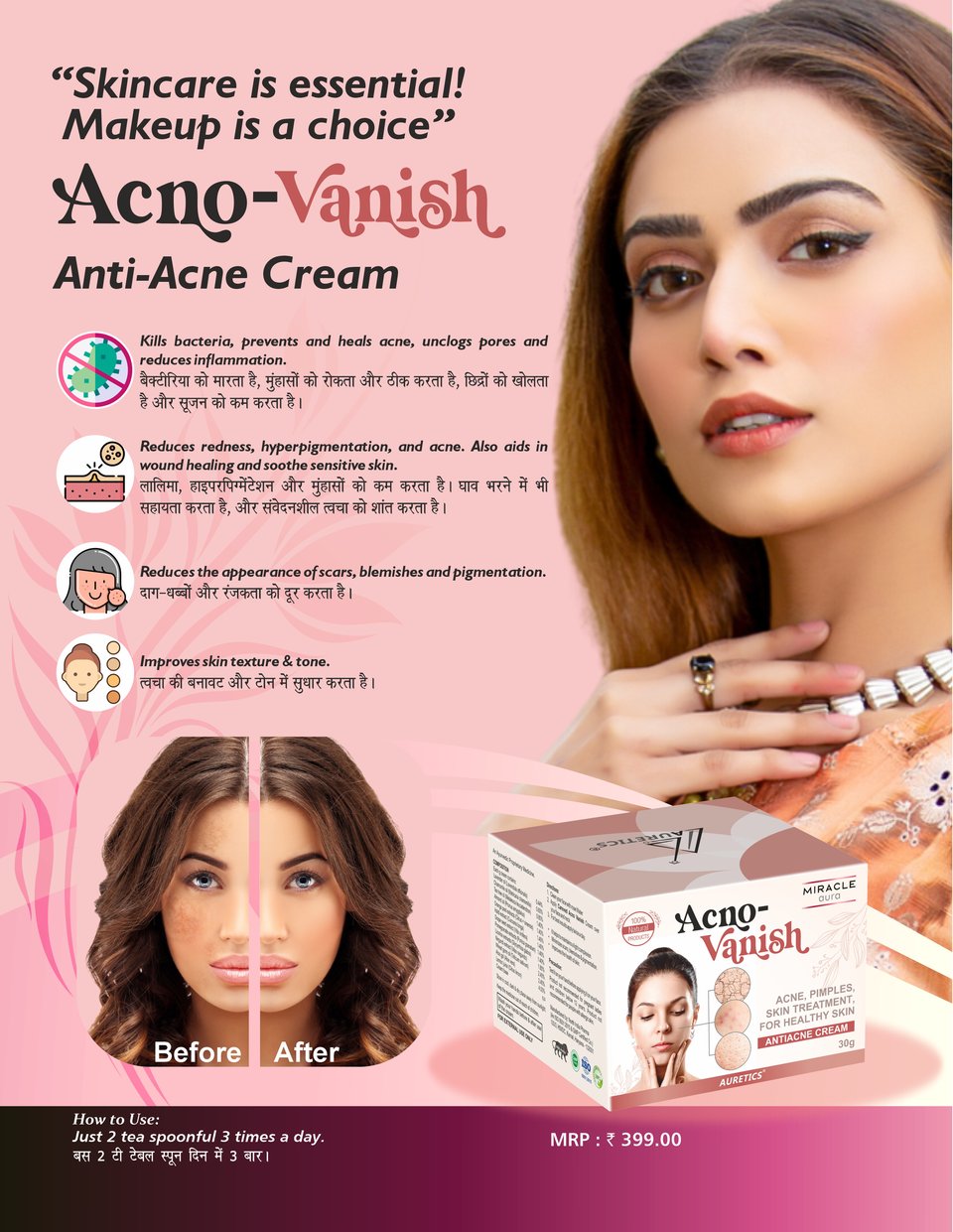 [1+1] MiracleAura: Acno Vanish - Anti Acne Cream Post GST | Auretics ...